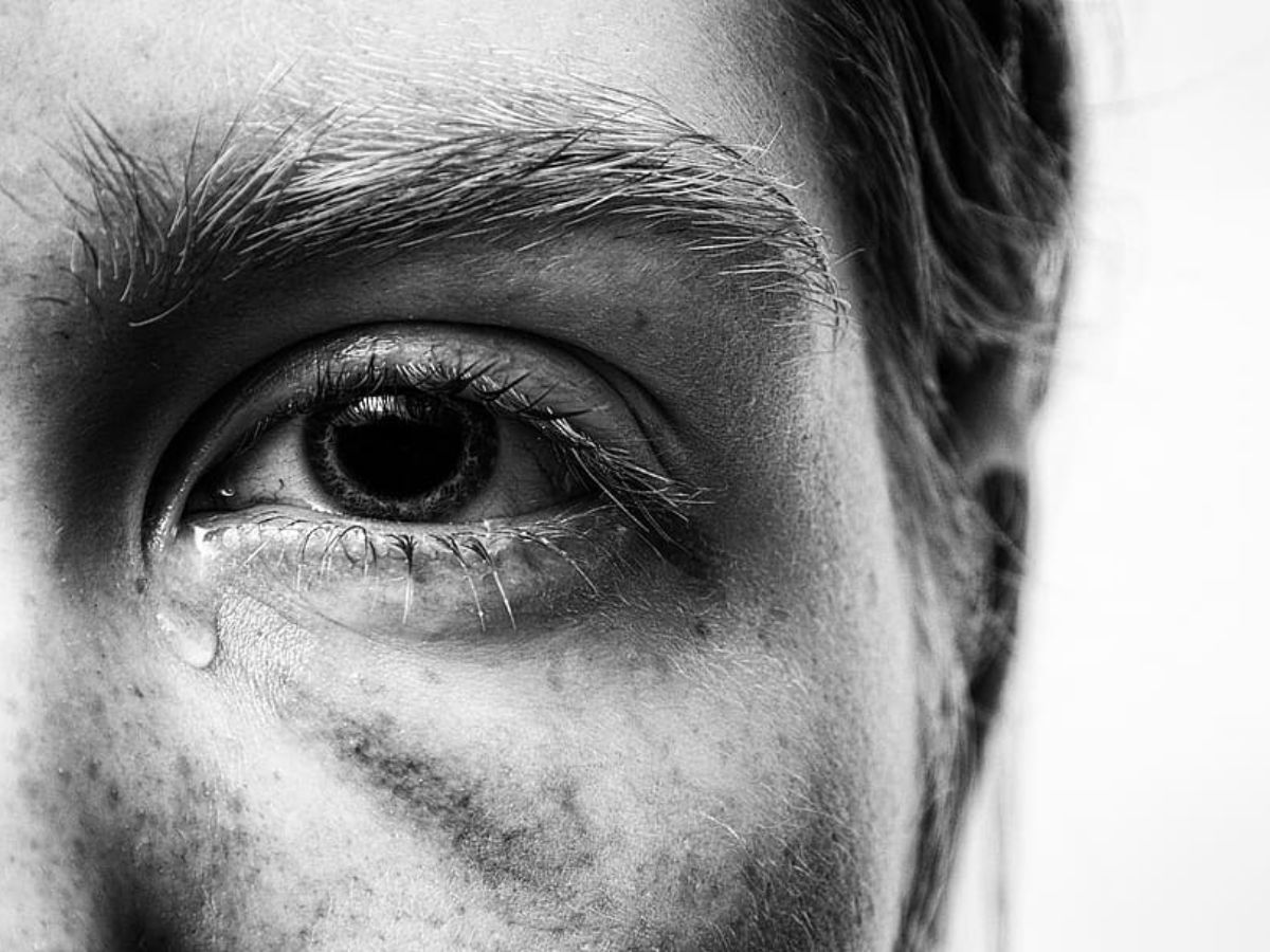 Tales of male acid attack victims - Sakshi Agrawal :: Nepal Minute ...